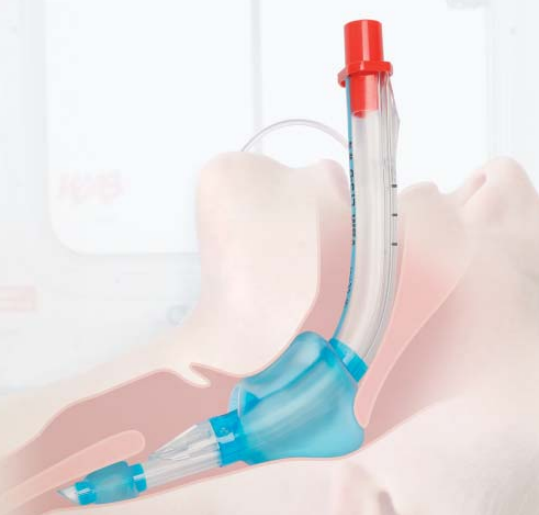 VBM - Tubo laríngeo